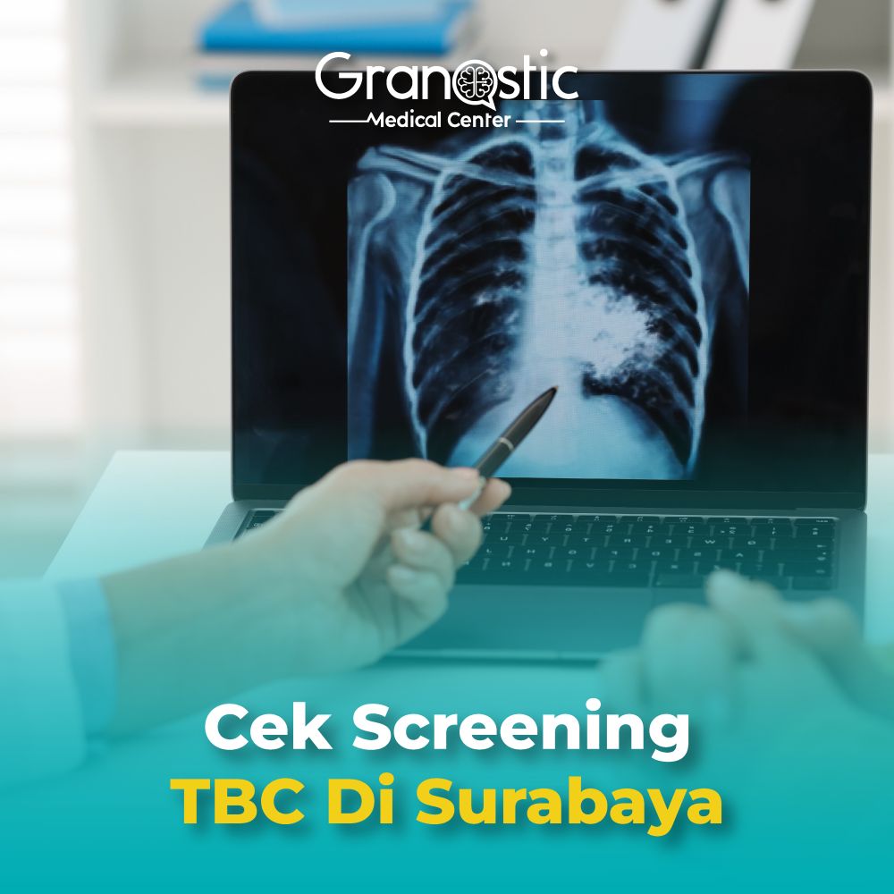 Cek Screening TBC di Surabaya
